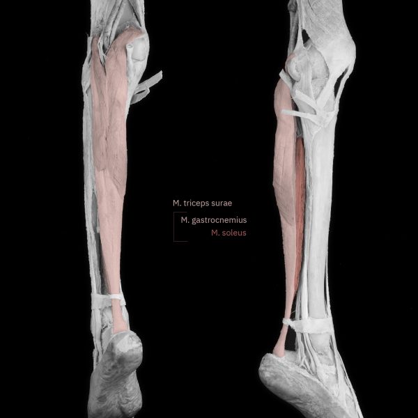 IG: M. triceps surae – präpApp – Early Access