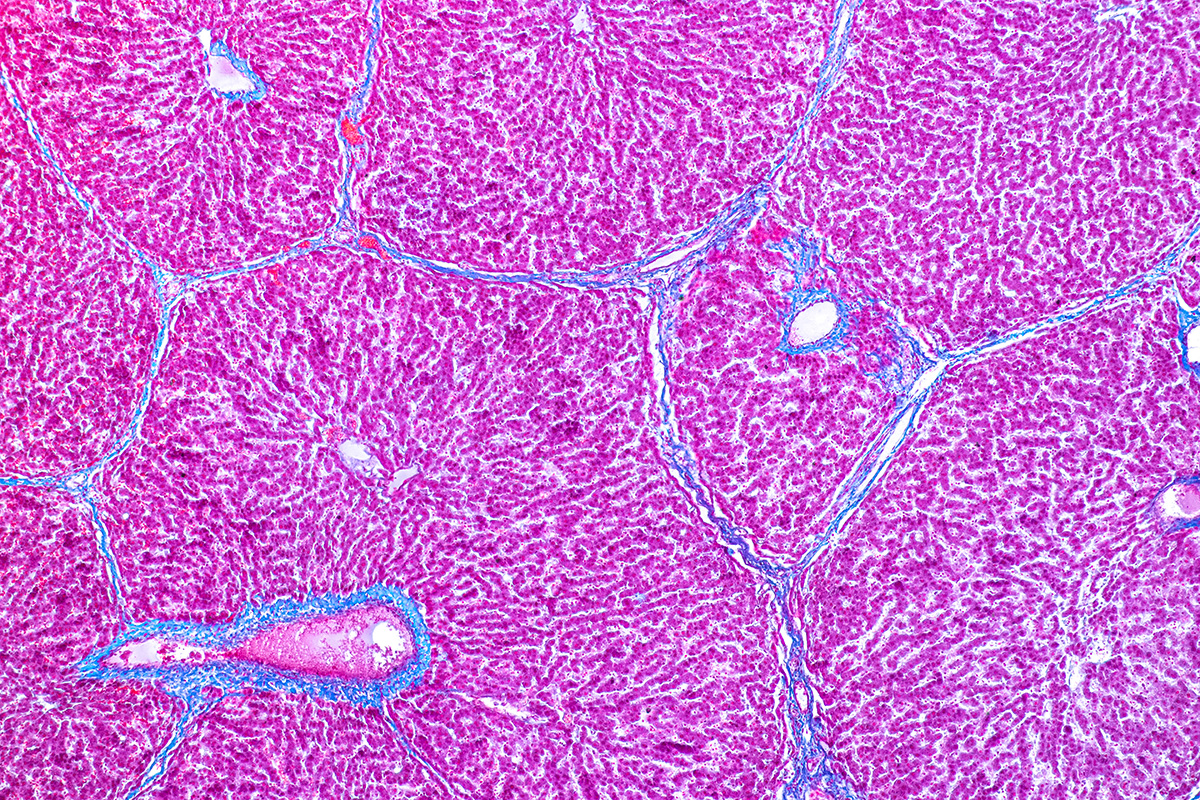Leber: Histologie – präpApp – Early Access