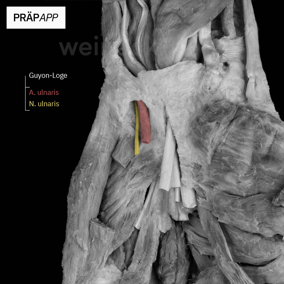 IG: Guyon-Loge – präpApp – Early Access