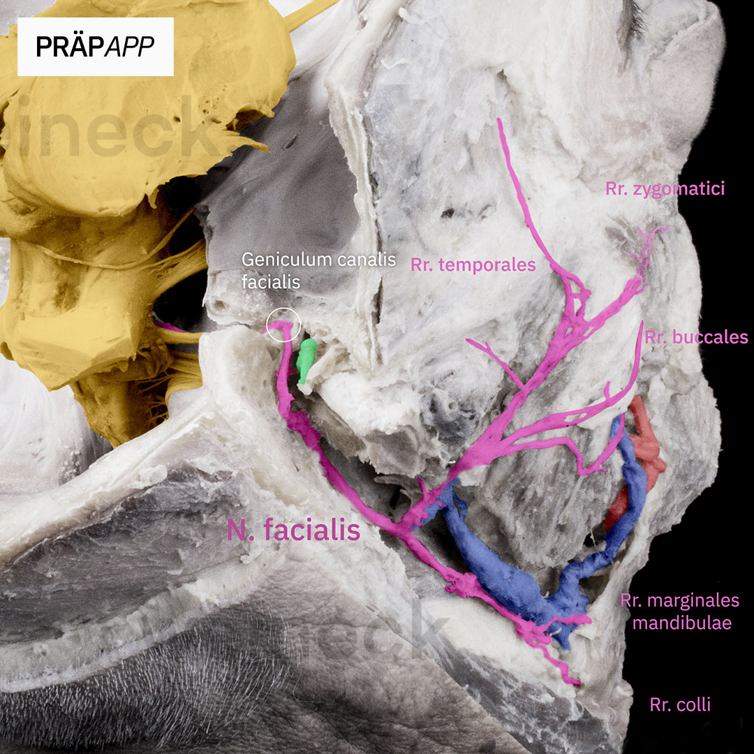 IG: N. facialis (VII) – präpApp – Early Access