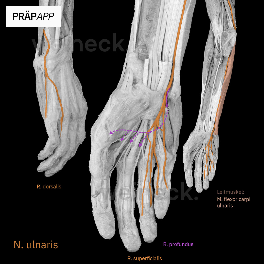 IG: N. ulnaris – präpApp – Early Access